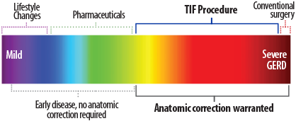 About Transoral Incisionless Fundoplication (TIF) procedure